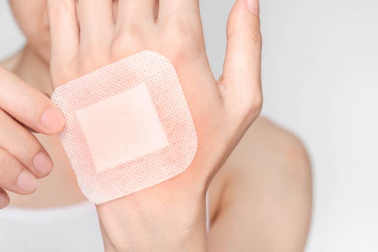 Managing Skin Color Changes Post-Keloid Cryotherapy Treatment