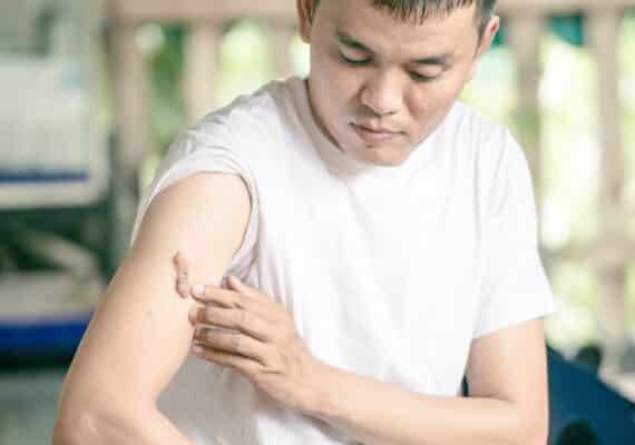 Keloids vs Hypertrophic Scars: Key Differences Explained